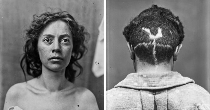 20 Haunting Medical Portraits Of Harvey Cushing’s Patients In The Early ...