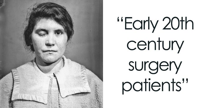 20 Haunting Medical Portraits Of Harvey Cushing’s Patients In The Early ...