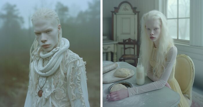 My Photo Series “Porcelain Beauty”, Showcasing People With Albinism ...