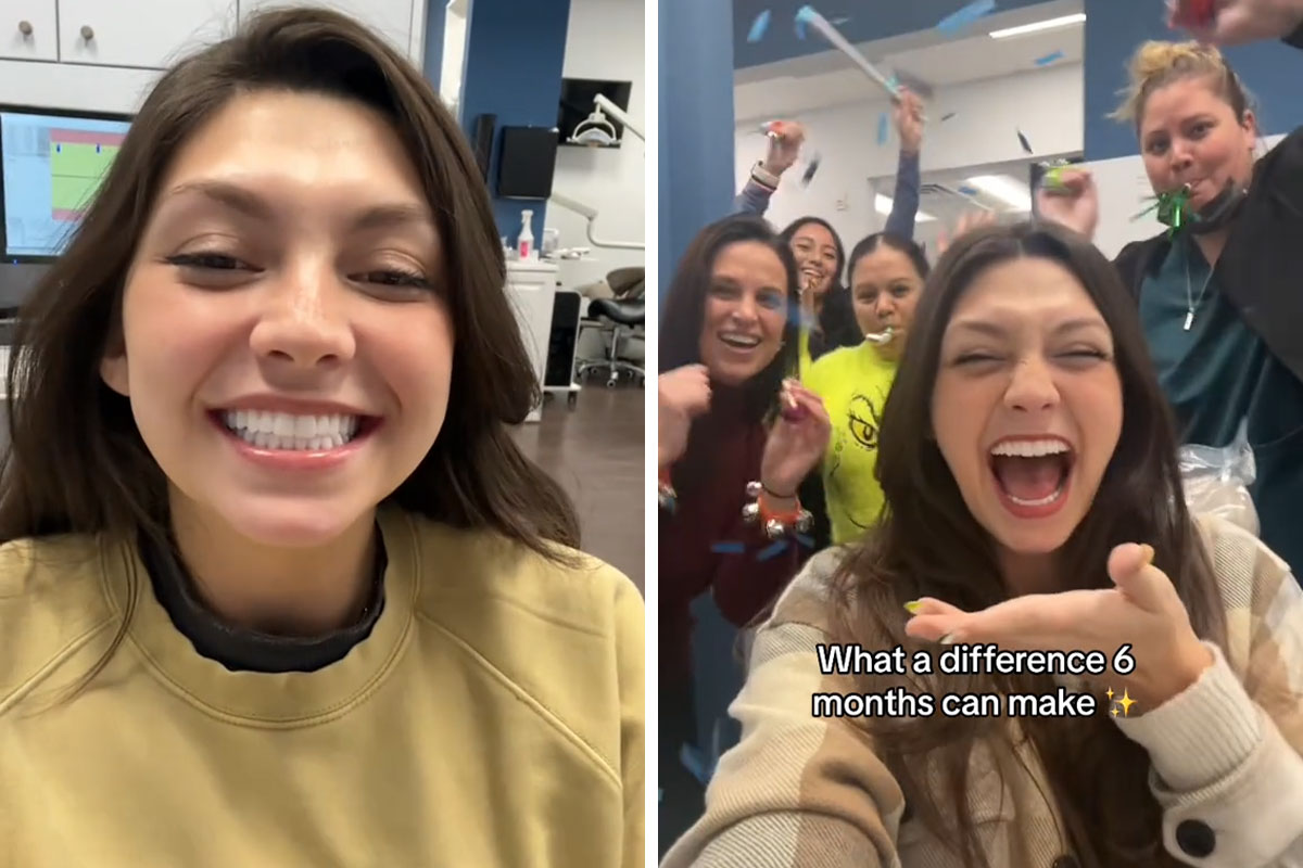 After Having All Her Teeth Pulled Out At 20, Woman Shares “Before/After ...