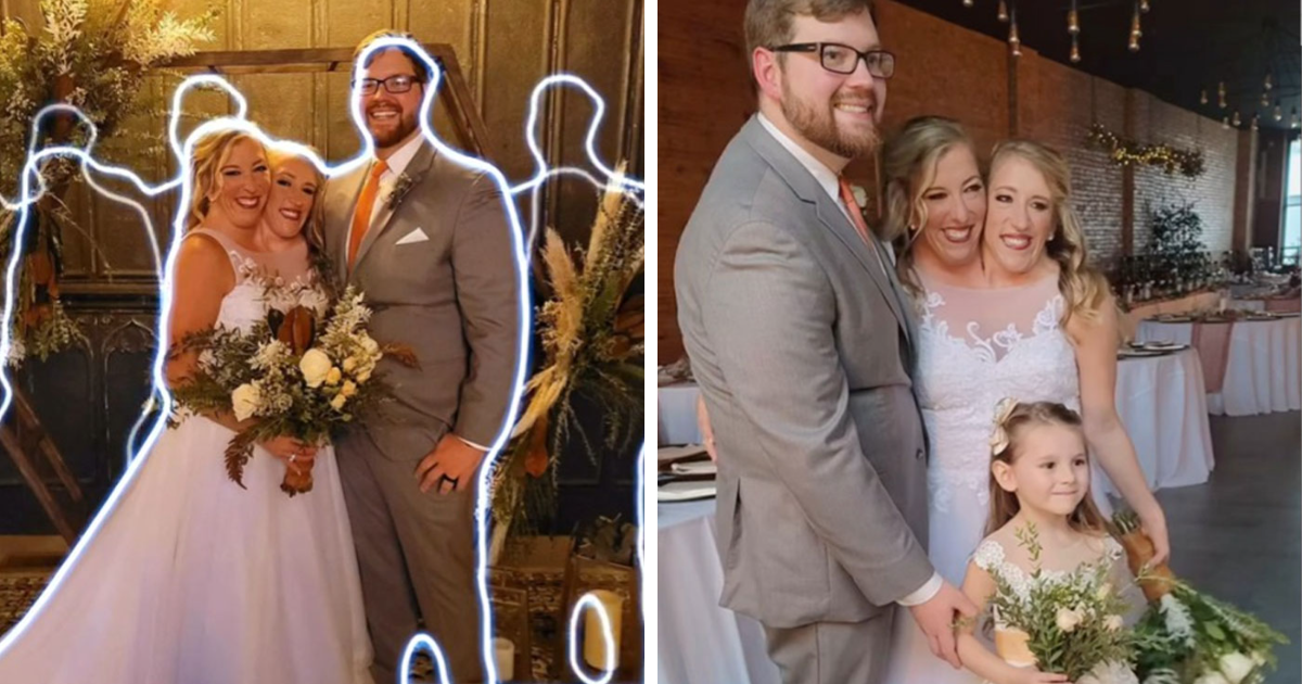 Conjoined Twin Abby Hensel Finally Shares Photos From Wedding To US ...