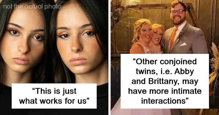 “Feels Like Someone Messing With Your Body”: Conjoined Twin Shares ...