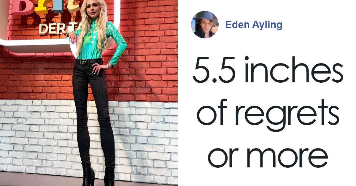 Model Who Spent $160k To Lengthen Her Legs By 5.5 Inches Left With ...
