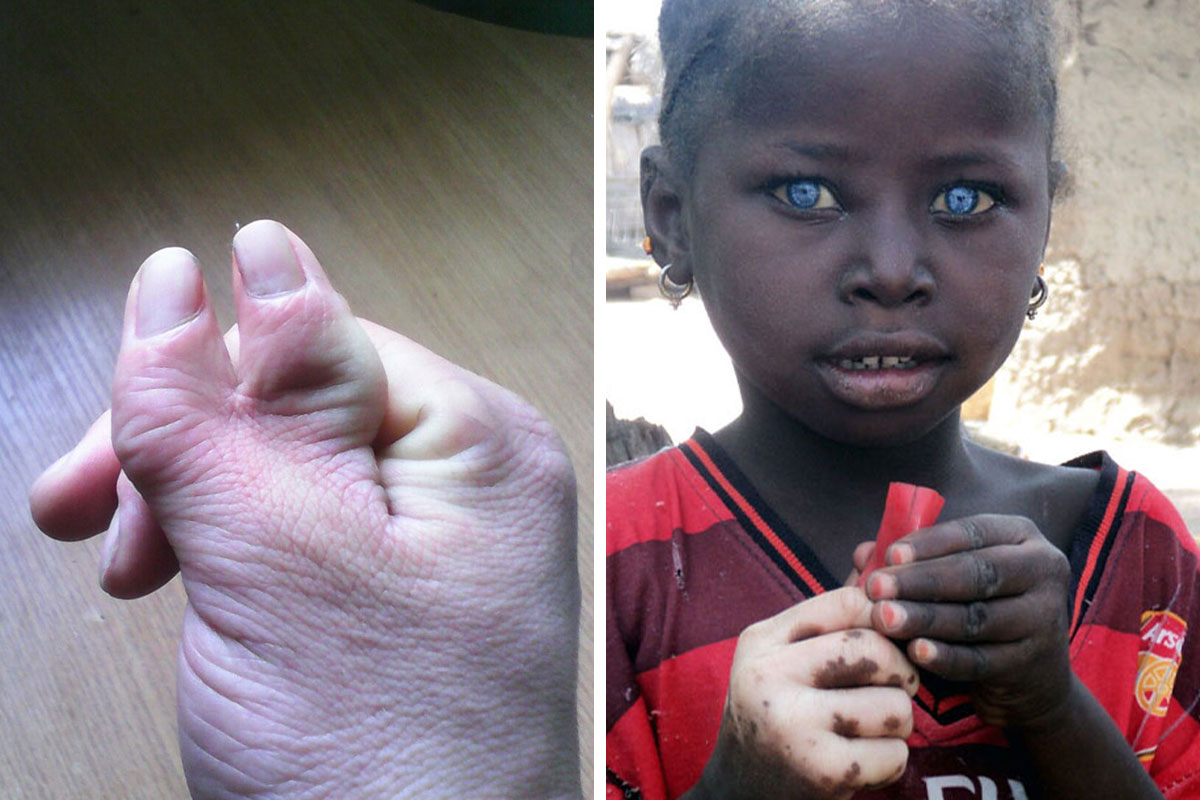 Jarawa Tribe Genetics