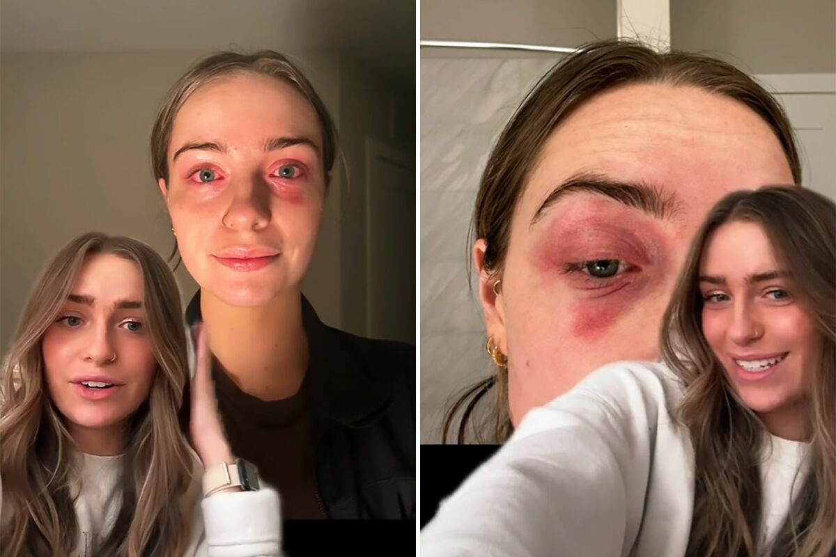 Woman Realizes She’s Been “Accidentally Poisoning” Herself For Months ...