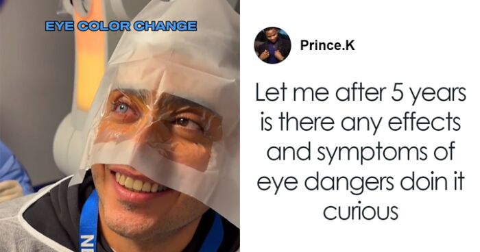 Patients Increasingly Changing Eye Color With Surgery Despite Over 90% ...