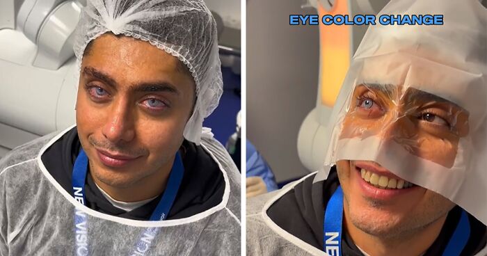 Patients Increasingly Changing Eye Color With Surgery Despite Over 90% ...