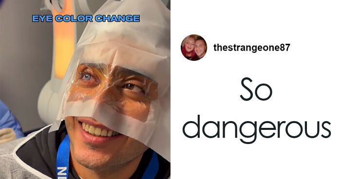 Patients Increasingly Changing Eye Color With Surgery Despite Over 90% ...