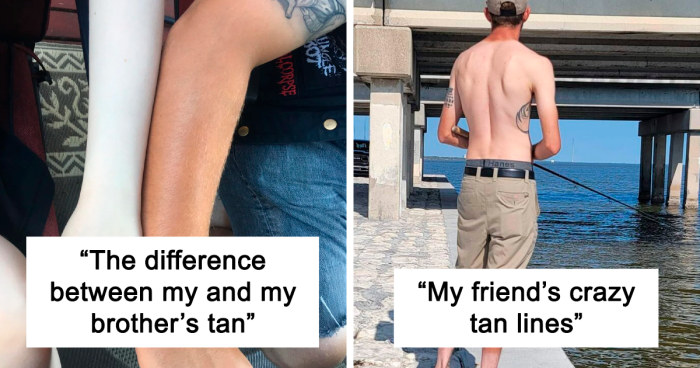 50 Times People Posted Their Embarrassing Sunbathing Fails So You Can ...
