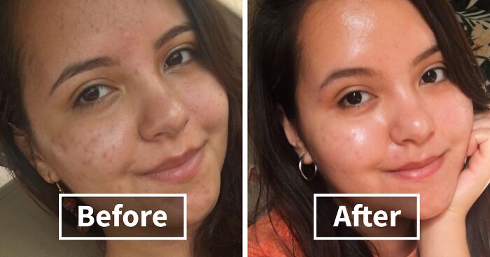 These 10 COSRX Products Are So Good, They Can Hardly Stay On The Shelves