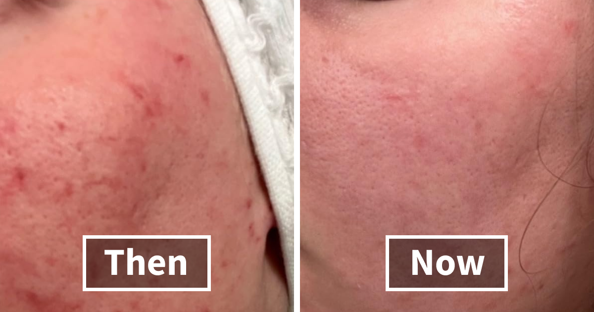 These 10 COSRX Products Are So Good, They Can Hardly Stay On The ...