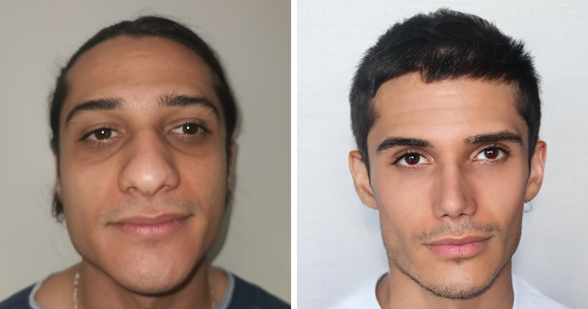 “He Needs A New Identity”: Man Looks Unrecognizable After Going To ...