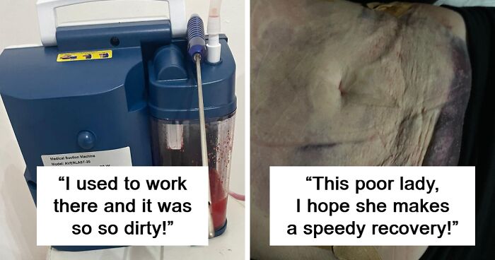 Woman Hospitalized After Liposuction Procedure Using AliExpress Dental ...