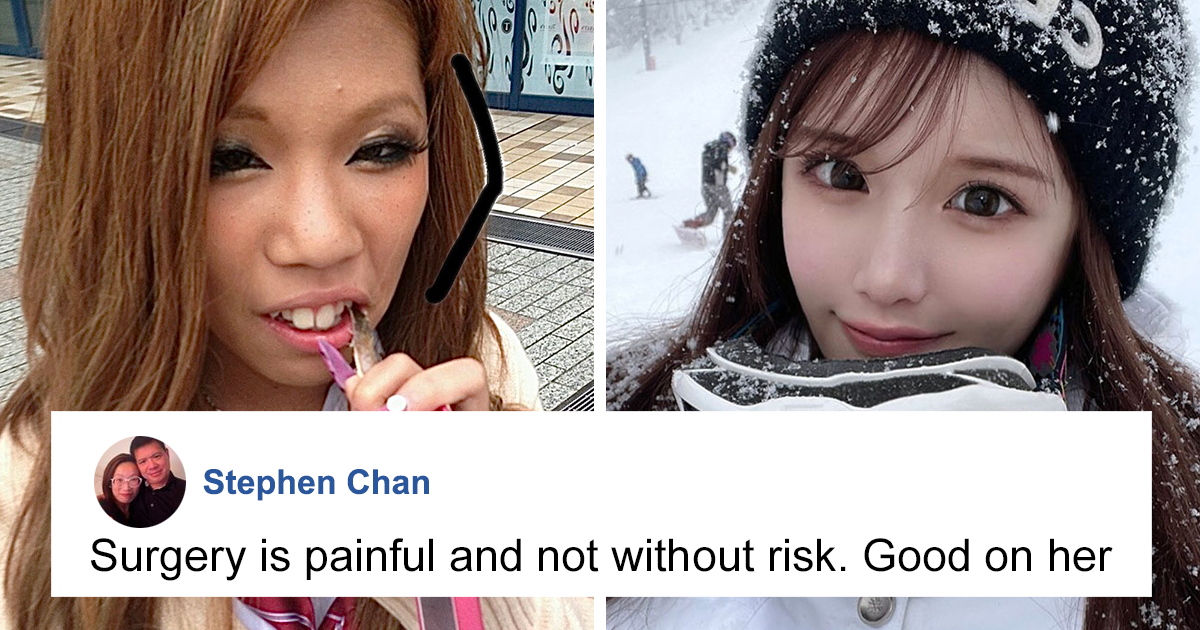 “Finally Beautiful”: Japanese Model Becomes Unrecognizable After 20 ...