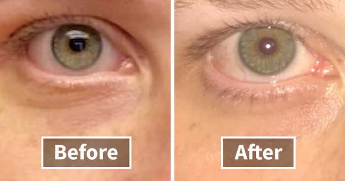 18 Beauty Products That’ll Make You Appear Well-Rested (No Matter How ...