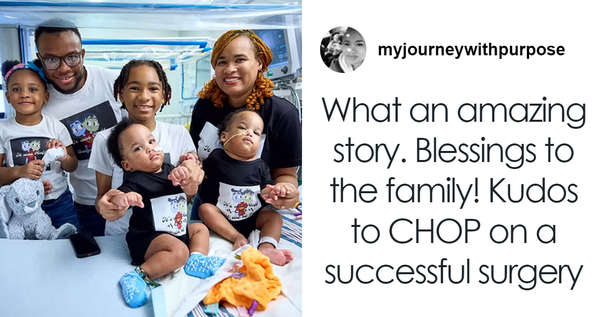 “So Grateful”: Mom Of Successfully Separated Conjoined Twins Reveals ...