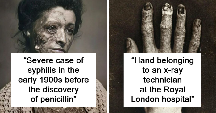 “History Everyday”: 50 Interesting Historical Pictures That Might Teach ...