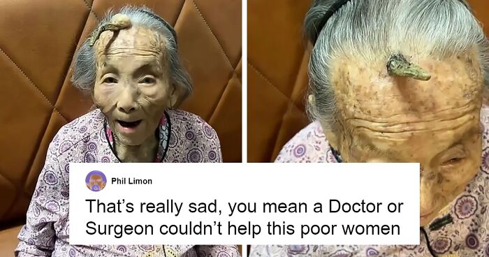 “It’s Too Risky”: 107YO Goes Viral For 4-Inch “Longevity Horn” Growing ...