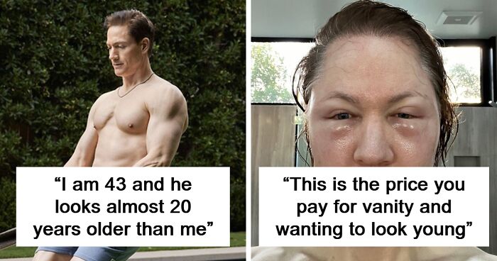 Billionaire Trying To Reverse Aging Injected Fat Into His Face—Reveals ...