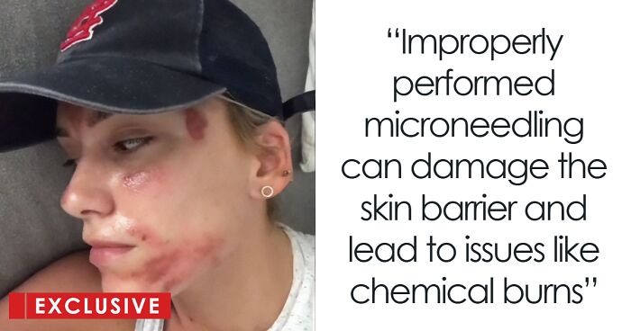 Amid Viral Injuries, Skin Expert Exposes Dangers Of Botched ...
