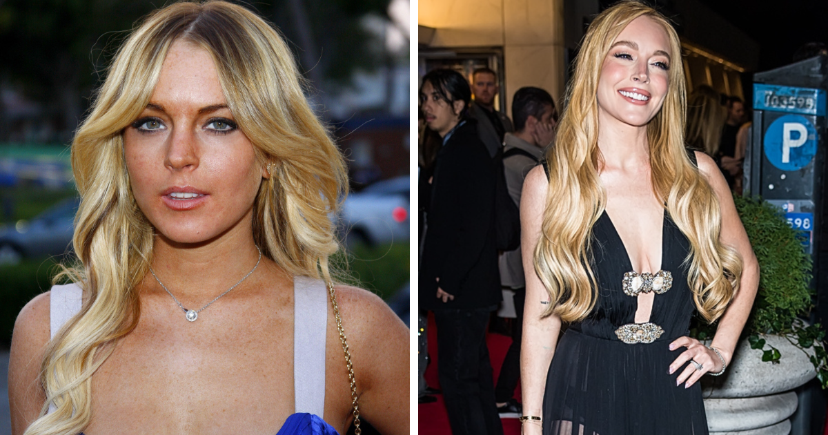 Lindsay Lohan 2024 Plastic Surgery