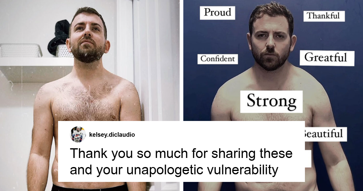 “Ashamed And Embarrassed”: Man Without An Anus Reveals His Peculiar ...