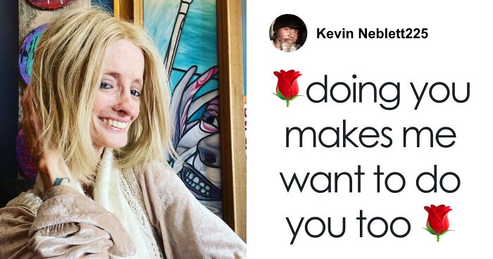 “Right Now Is All We Have”: Woman With Rare ‘Benjamin Button’ Condition ...