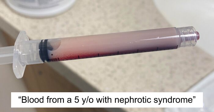 50 Interesting Medical Cases That Might Make You Appreciate The Human ...