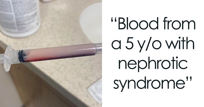 50 Interesting Medical Cases That Might Make You Appreciate The Human ...