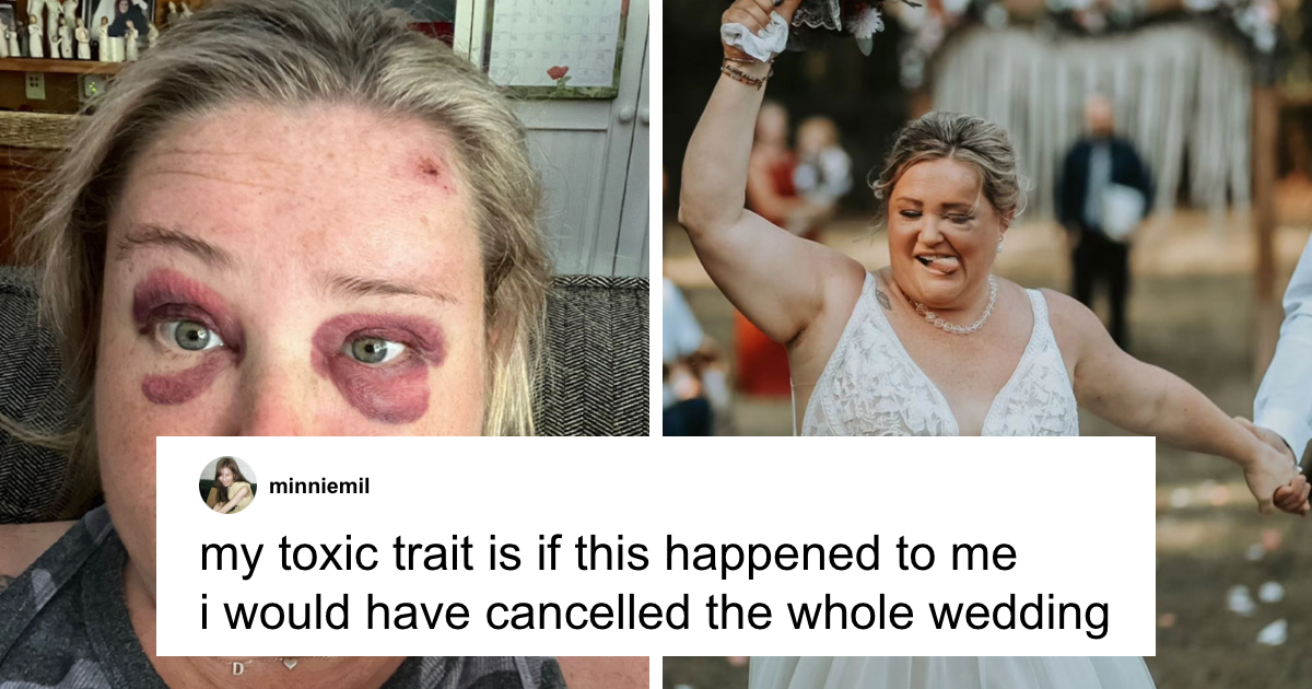 Netizens Say Makeup Artist “Nailed It” After Hiding Bride’s Facial ...
