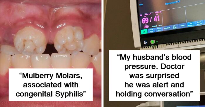 50 Interesting Medical Cases That Might Make You Appreciate The Human ...