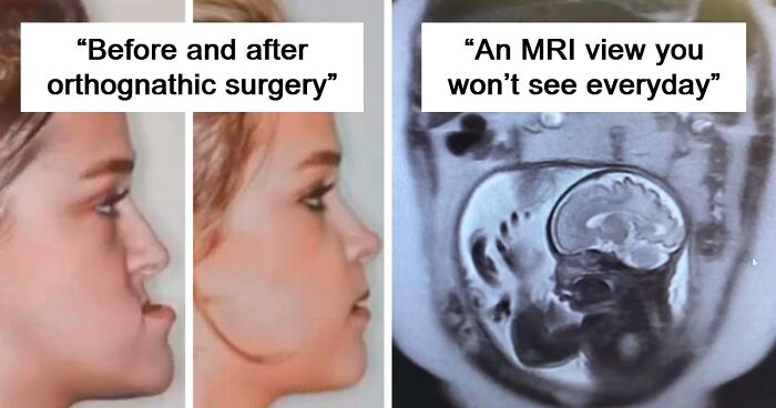 50 Interesting Medical Cases That Might Make You Appreciate The Human ...