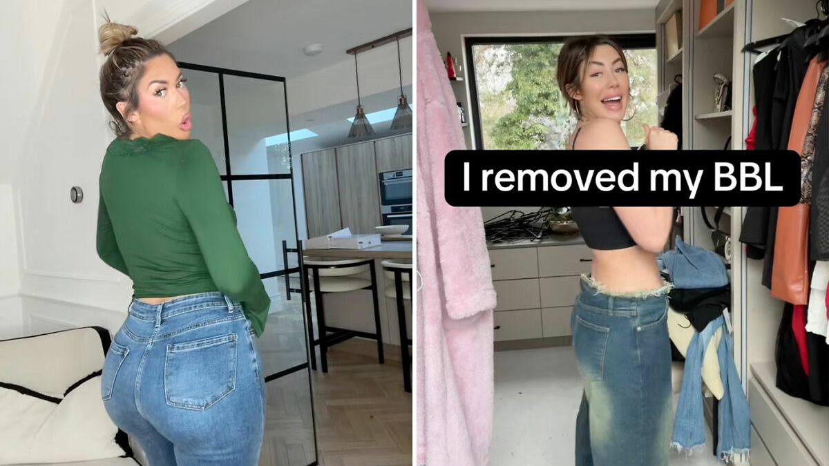 Woman Flaunts New Figure After Getting BBL Removed, Hitting ‘Rock Bottom’ Over Botched Surgeries ...