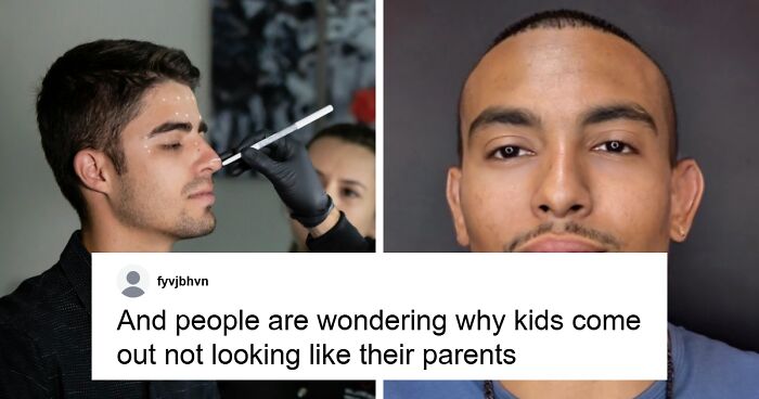 “How Scary”: Patient’s Plastic Surgery Results That Took Decades Off ...