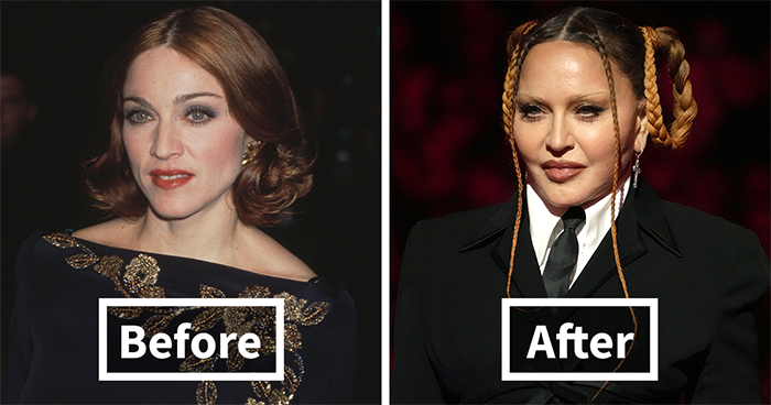 Going Under The Knife Has Had Some Brutal Effects On These 23 ...