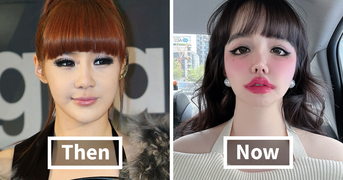 K-Pop Star Stuns Fans With Bizarre Transformation Amid Cosmetic Surgery ...