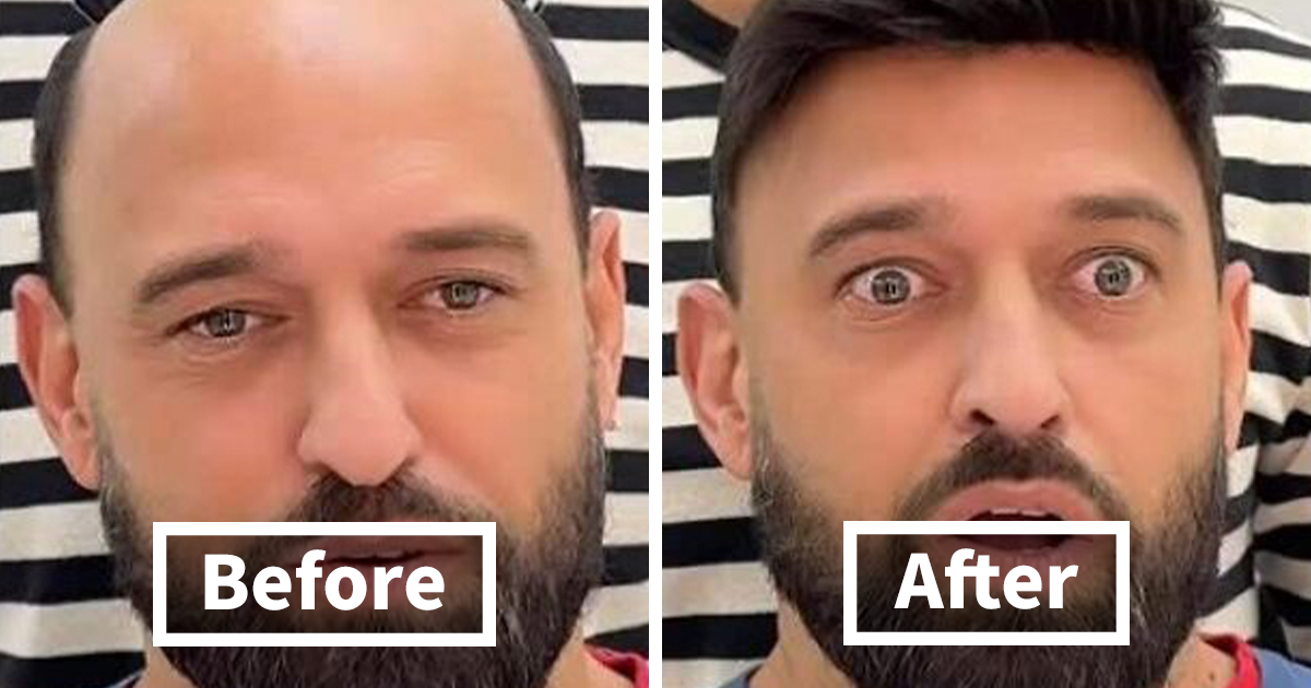 40 Stunning Before And After Hair Transformations That Gave These ...