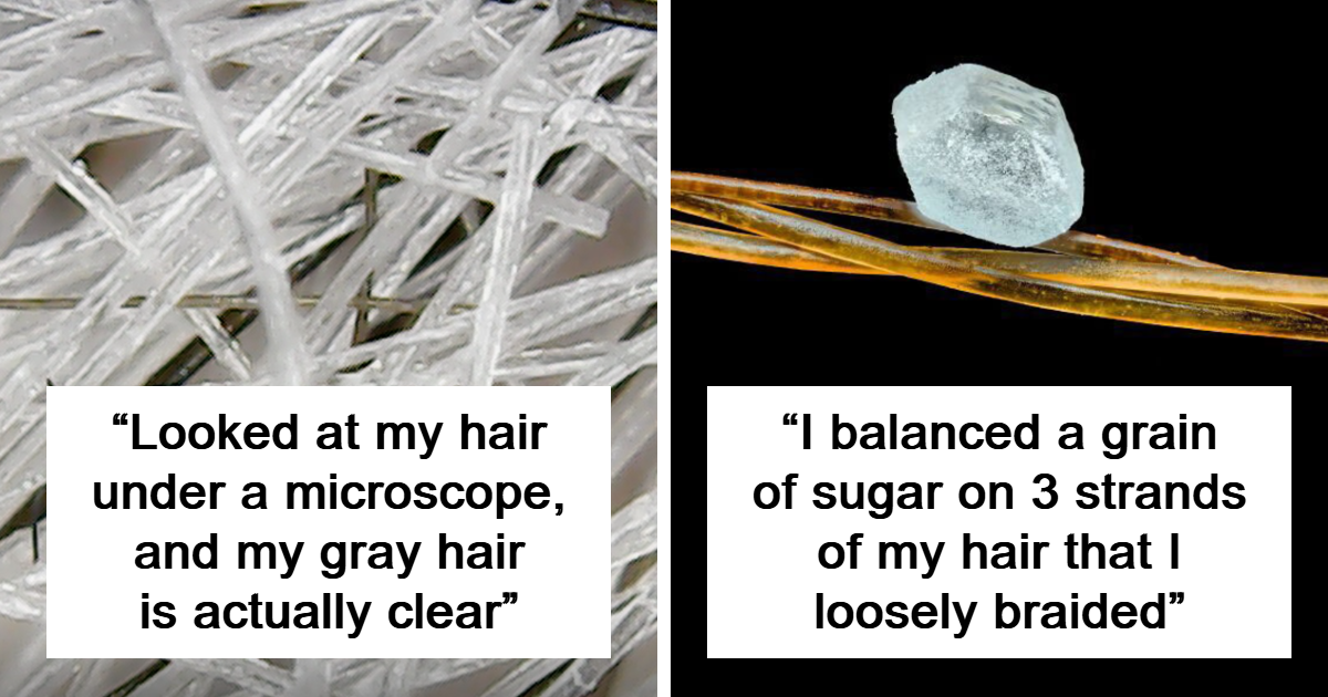 “Water Flea Having 6 Babies”: 70 Incredible Microscopic Images Captured ...