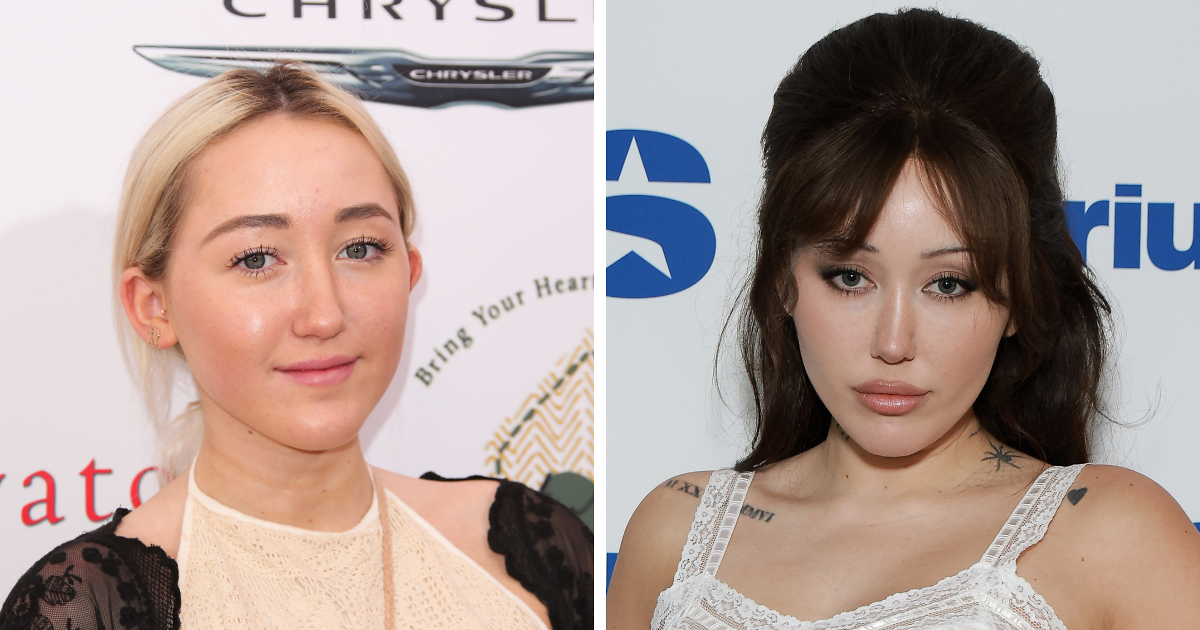 Miley Cyrus' Sister Noah, 25, Sparks Plastic Surgery Rumors With ...
