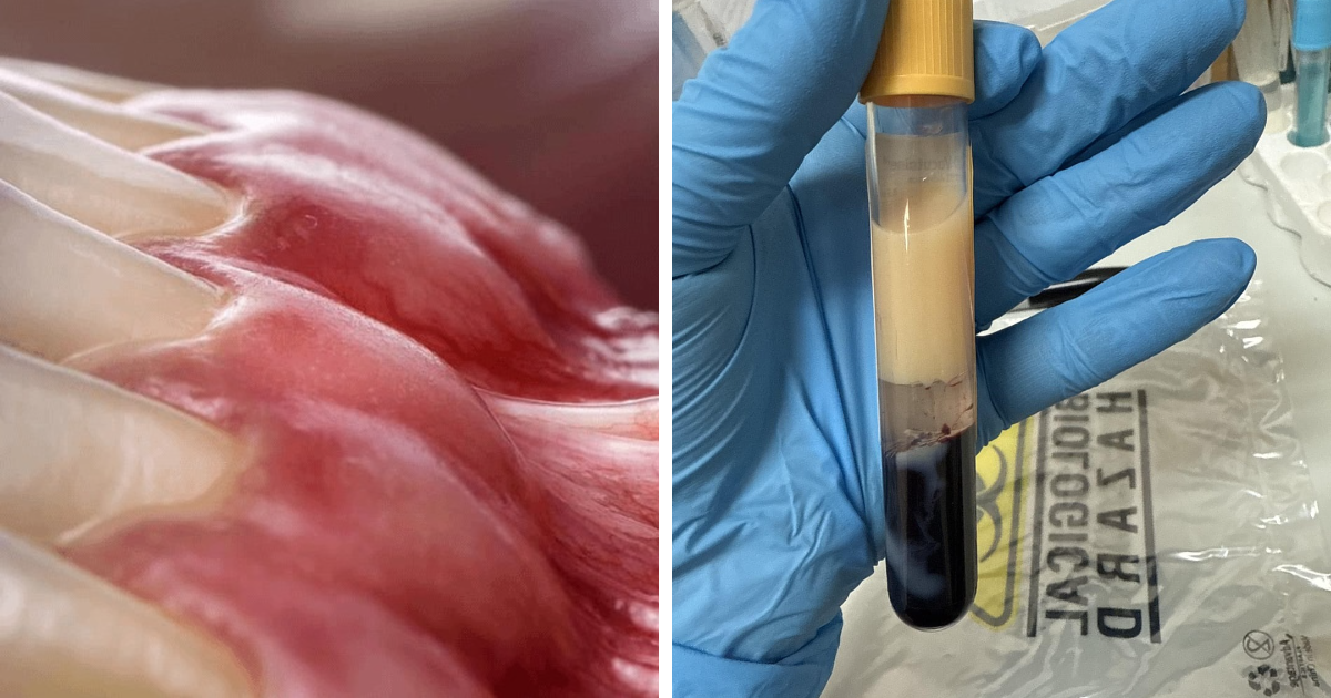 42 Medical Posts That Prove Truth Is Sometimes Stranger Than Science ...