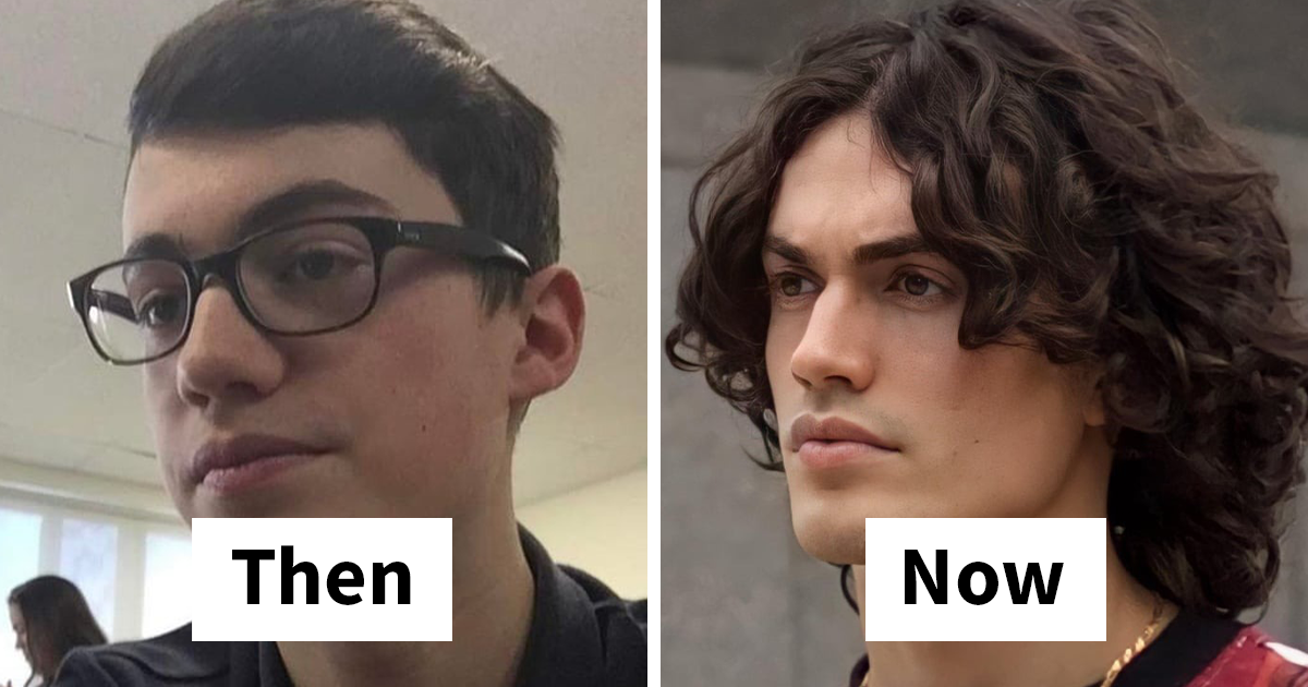 “Took 5 Years To Become A New Person”: 50 People Whose Transformations ...